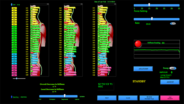 PulStar | Binghamton, NY Chiropractor | Two Rivers Chiropractic